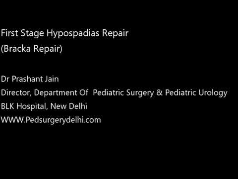 First Stage Hypospadias Repair (Bracka): Chordee Correction and Free Preputial graft