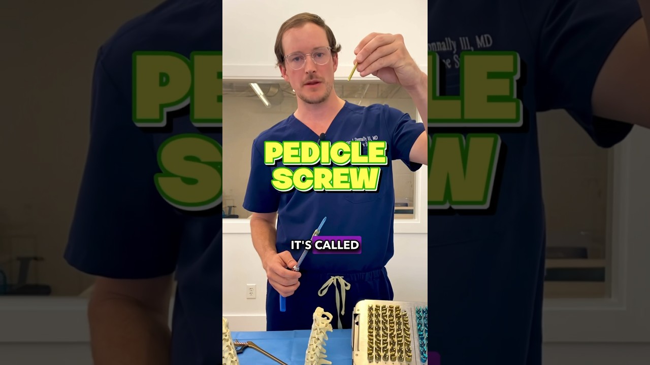 “Rods and Screws” 𝐒𝐩𝐢𝐧𝐚𝐥 𝐅𝐮𝐬𝐢𝐨𝐧 𝐄𝐱𝐩𝐥𝐚𝐢𝐧𝐞𝐝