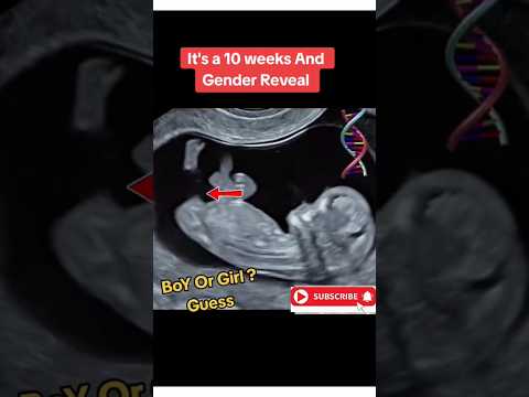 10 weeks pregnancy ultrasound baby or girl🥰🥰🥰|#viral #trending