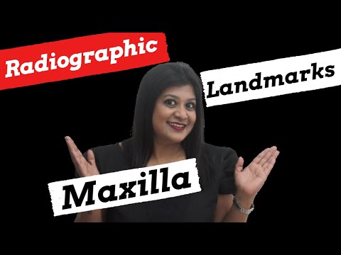 MAXILLARY LANDMARKS IN RADIOLOGY| DENTISTRYBYPRATS