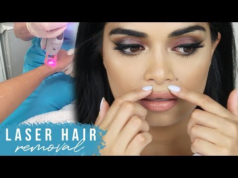 MY LASER HAIR REMOVAL JOURNEY 😱The Cosmetic Clinic 💕