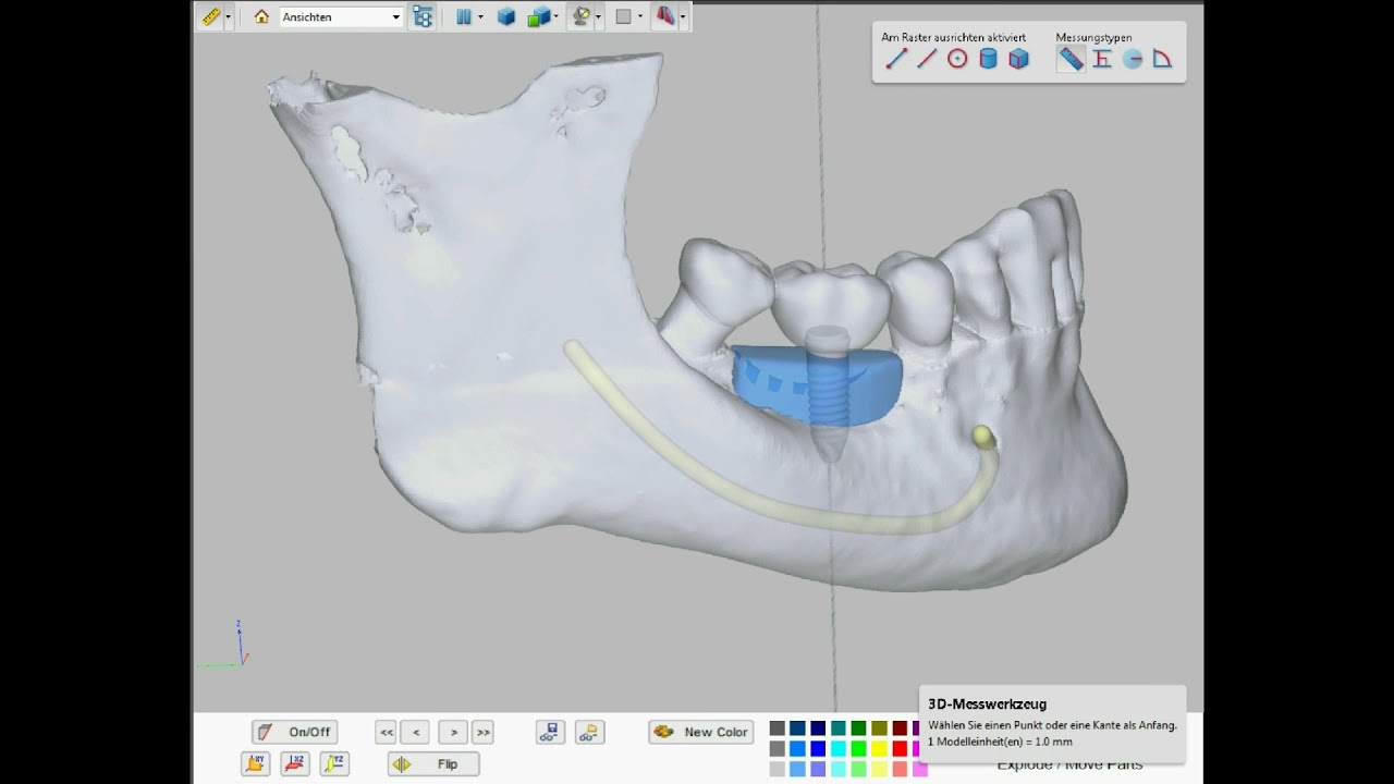 3D PDF Tutorial – maxgraft® bonebuilder design - how to measure the block design