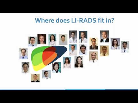 13. LI-RADS: HCC Treatment Response: from Concepts to Algorithms - Part 1. By Dr. Richard Do.
