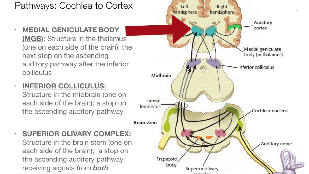 Perception:10.1 - The Auditory Brain