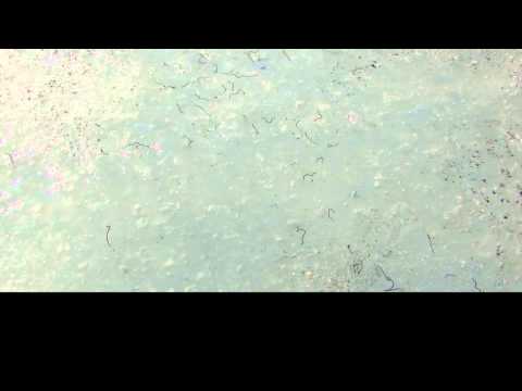 Glacier Ice Worms in Action – From a Glaciers Perspective