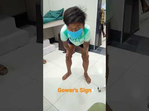 #myopathy #muscleweakness #dmd #gower Gower's Sign in proximal muscle weakness