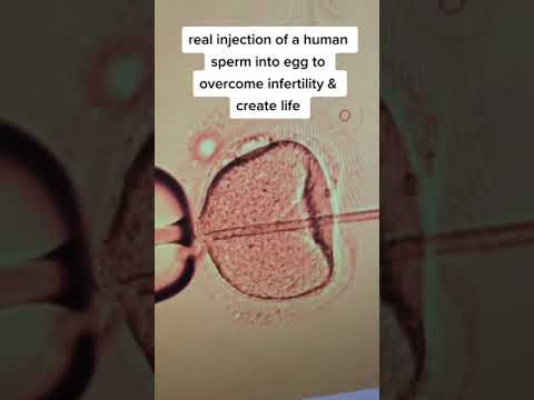 Real injection of sperm into a human egg to create a new life