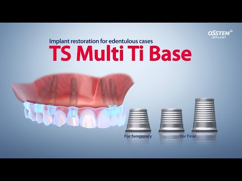 TS Multi Ti Base- Ti Base for digital denture solution