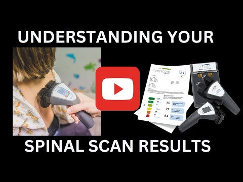Nervous System Scan interpretation