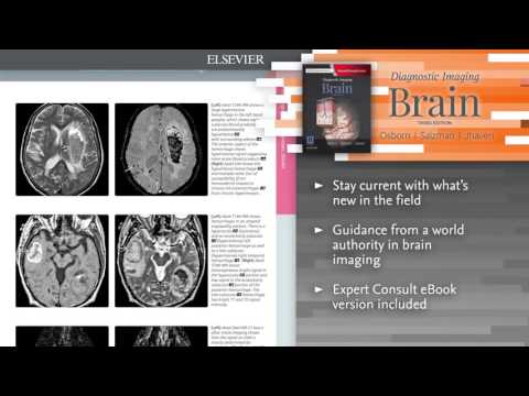Diagnostic Imaging: Brain, 3e