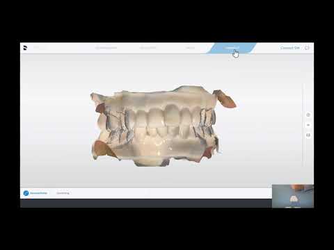 SureSmile via Connect SW