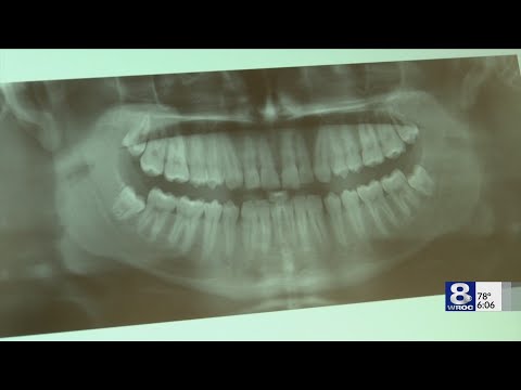 Eastman Dental Center oral surgeons reducing opioid prescriptions