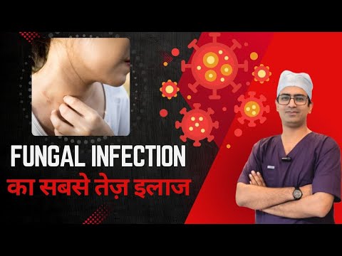 फंगल इंफेक्शन से राहत क्यों नहीं मिल रही? /Recurring Fungal Infections: What’s Making Them Stubborn?