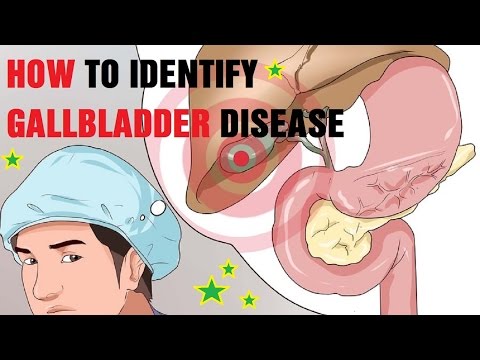 How to Identify Gallbladder Disease