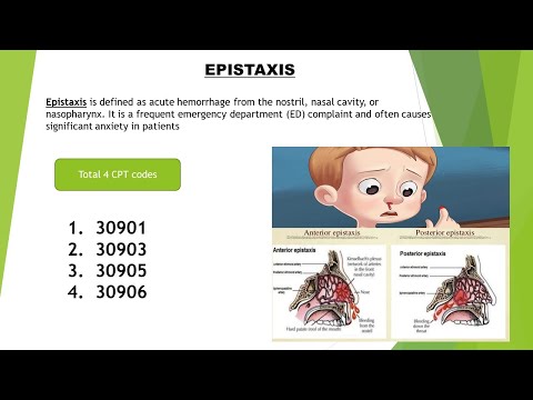 Epistaxis (Nosebleed) CPT Coding | ED & Surgery Coding | Medical coding | ICD & CPT Assign codes.