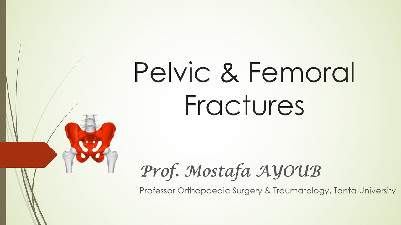 21-Pelvic and Femoral Fractures by Prof.Dr. Mostafa AYOUB for Medical Students