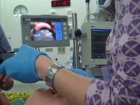 VIDEOLARINGOSCOPIA C-MAC 2011 (1).MP4