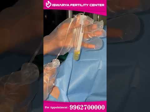 Step By Step | Egg Retrieval Procedure | Iswaryafertilitycenter