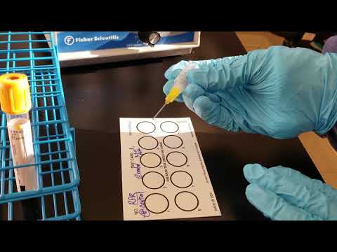 Microbiology: Rapid Plasma Reagin (RPR) Test