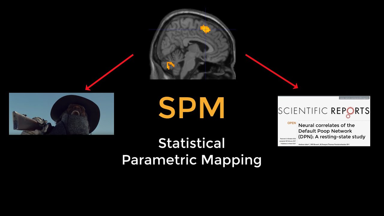 SPM Introduction: Download and Install