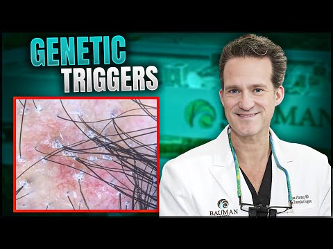 The SHOCKING Truth Behind Hair Loss