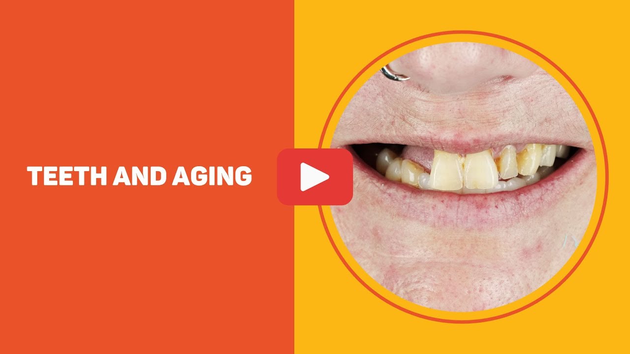 Teeth and Aging