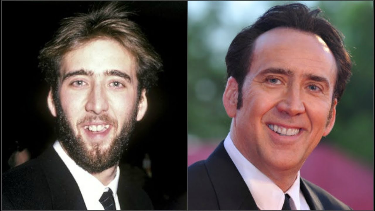 TOP-10: Celebrity teeth before and after -  the most amazing teeth transformations!