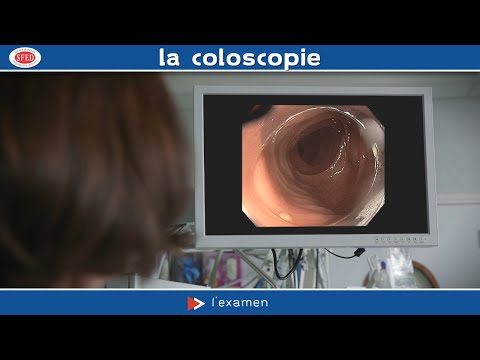 Qu'est que la coloscopie ? Le Dr Costil, gastroenterologue, vous ...