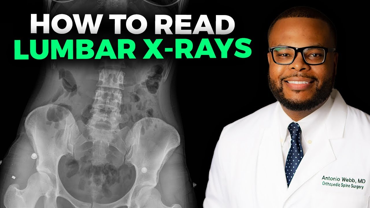 How to Read a Lumbar X-Ray