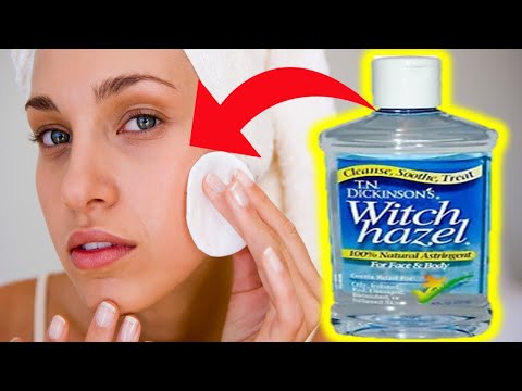 9 Incredible Witch Hazel Benefits For Skin Care (TONER SECRETS)