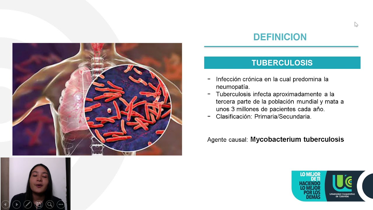 Presentación de PowerPoint  Grupo 5 Tuberculosis EPI