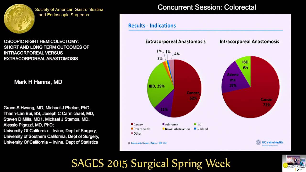 LAPAROSCOPIC RIGHT HEMICOLECTOMY SHORT AND LONG TERM OUTCOMES OF INTRACORPOREAL VERSUS EXTRACORPOREA