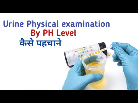 urine routine examination | Urine PH test