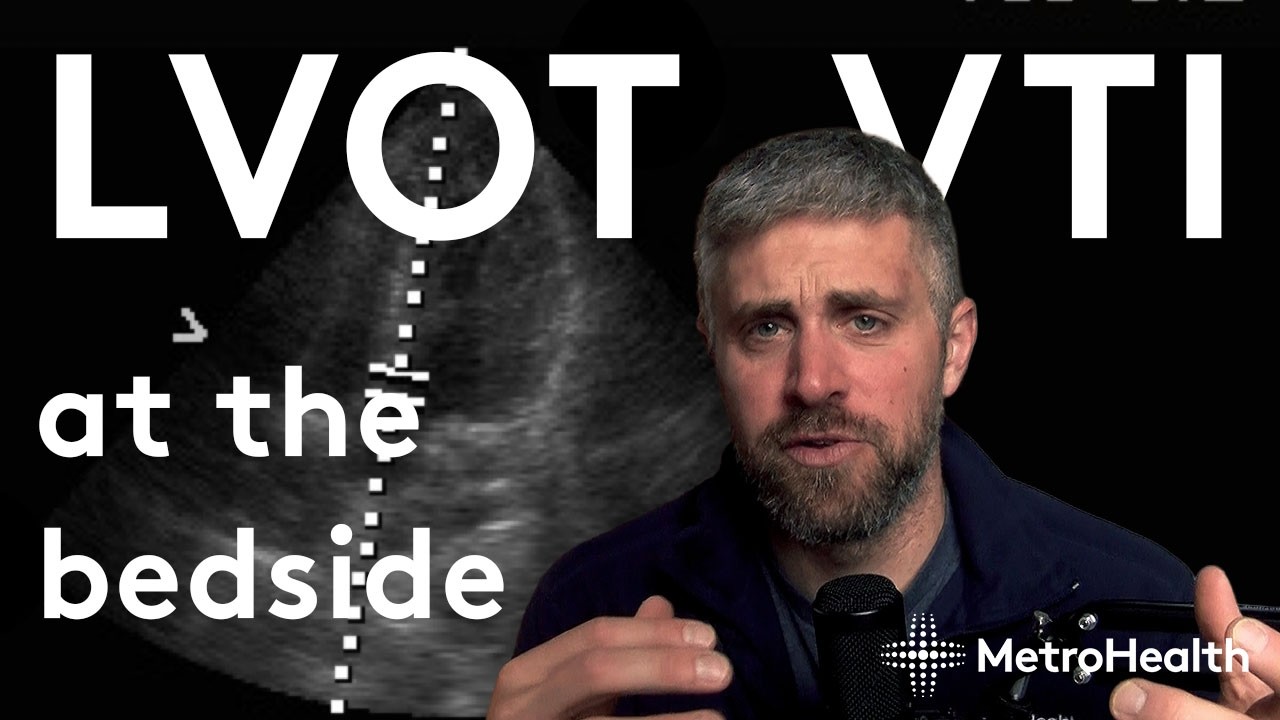 LVOT VTI at the Bedside