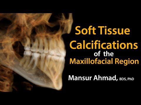 Soft Tissue Calcifications of the Maxillofacial Region