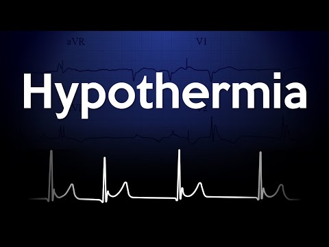 Hypothermia ECG Explained