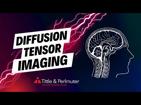 New Technology to Diagnose Traumatic Brain Injuries: Diffusion Tensor Imaging (DTI)