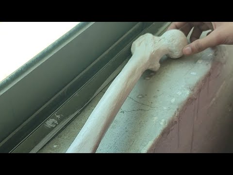 Femur bone|Side determination| Bony features|Gross Anatomy|Lower Limb in Urdu/Hindi
