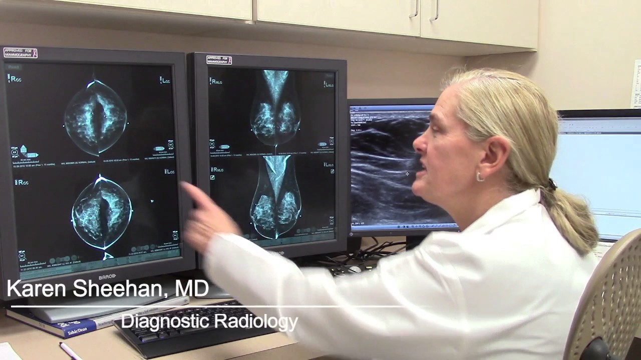 2D vs. 3D Mammograms: What You Need to Know