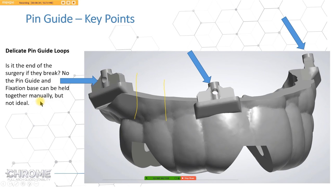 Pin Guide and Fixation Base - CHROME webinar series