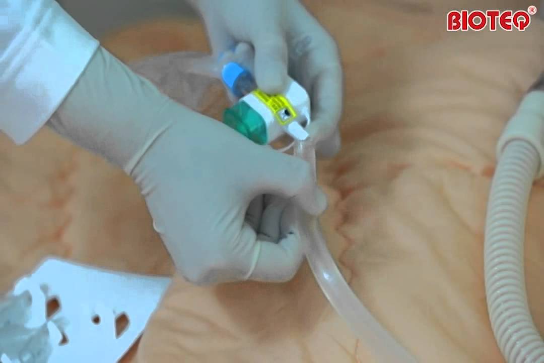 Pediatric Color Coded Y Closed Suction Catheter