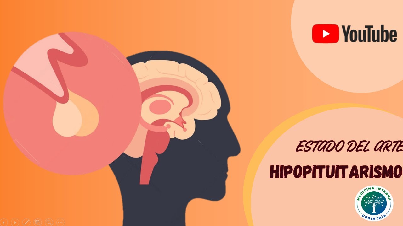 Hipopituitarismo
