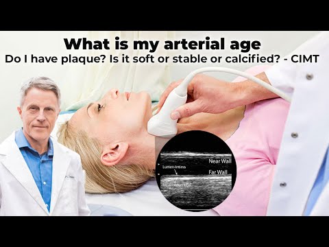 What is My Arterial Age? Do I Have Plaque? Is It Soft or Stable or Calcified? (CIMT)