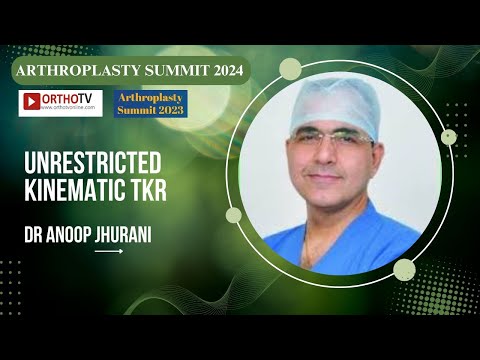 UnRestricted Kinematic TKR - Dr Anoop Jhurani
