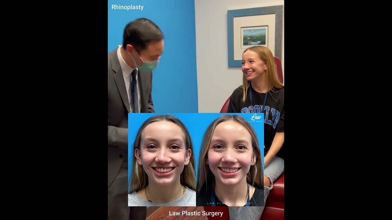 Cleft Rhinoplasty Patient Testimonial - Law Plastic Surgery