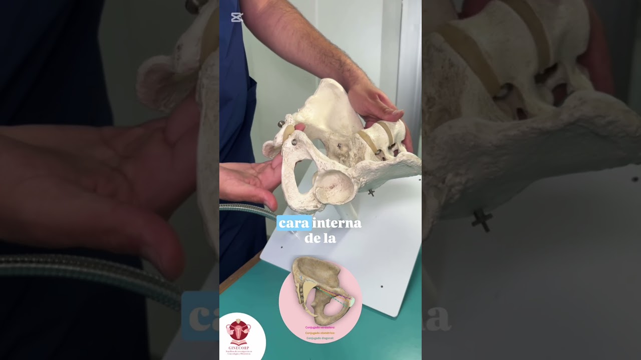 ¿Cómo saber si la pelvis es apta para un parto vaginal? #obstetrician