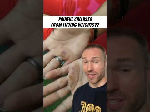 Painful Hand Calluses From Lifting?