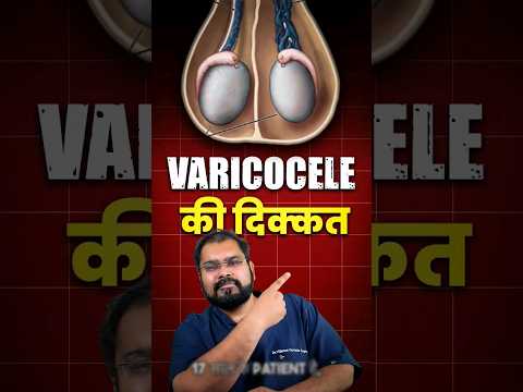 Varicocele Surgery #varicocelekailaj