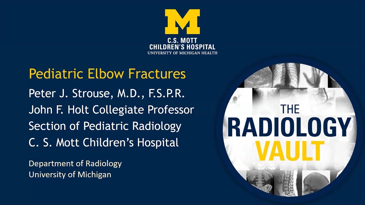 X-Ray of Pediatric Elbow Fractures