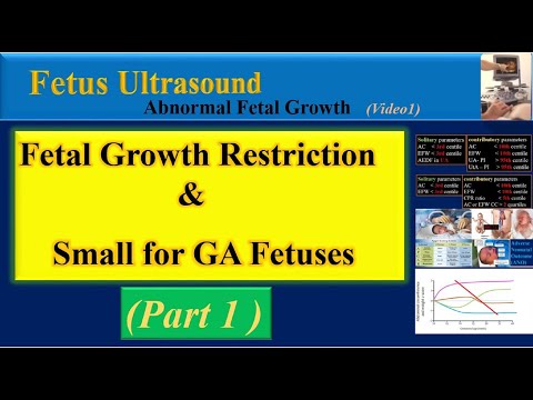 Fetus Ultrasound, Fetal Growth Restriction and Small for Gestational Age Fetuses Part1